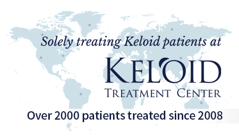 Keloid Specialist, Keloid Removal Expert, Keloid Treatment, New York