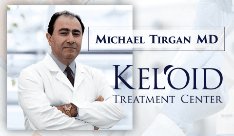 Keloid Specialist, Keloid Removal Expert, Keloid Treatment, New York